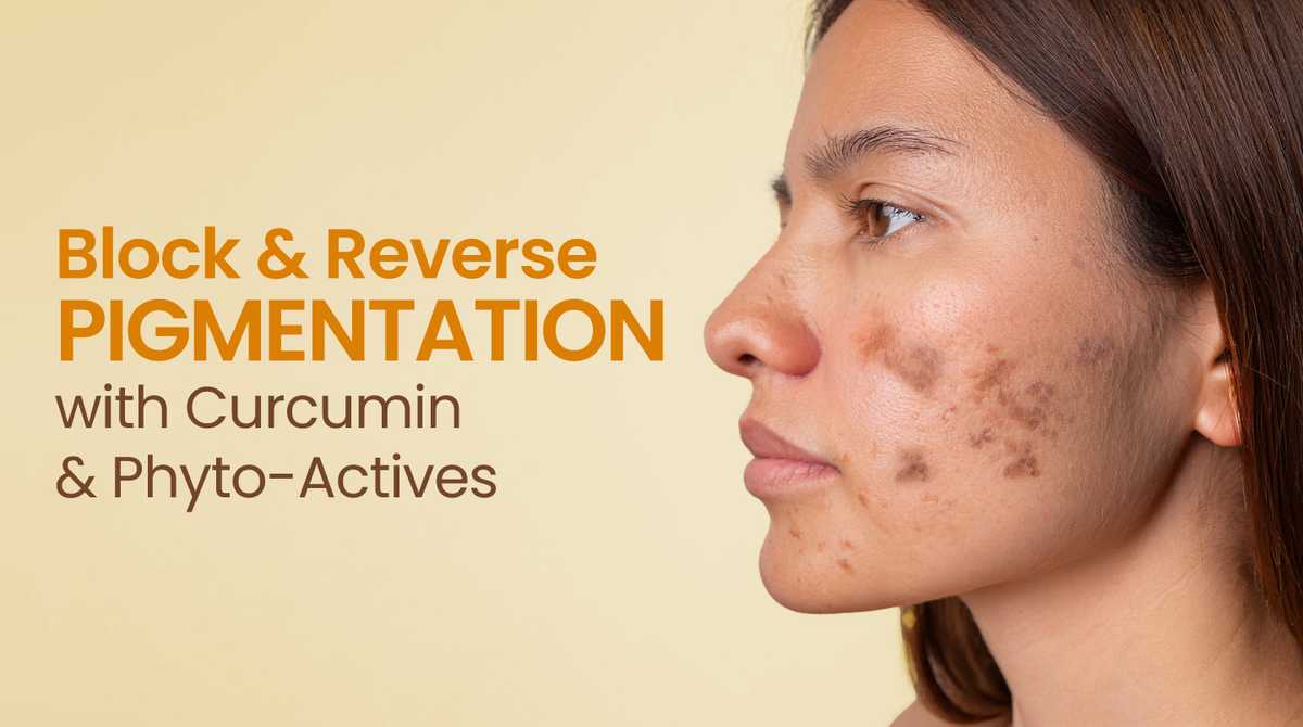 Pigmentation control-Nat Habit - 100% Natural & Fresh Made, Ayurvedic